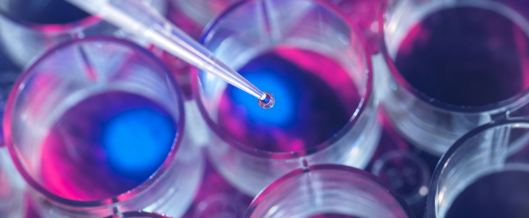 PEP-Therapy : innovative CP&IP technology